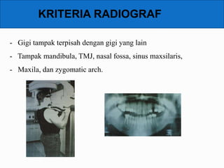 Teknik Radiografi 2 Panoramic | PPTX