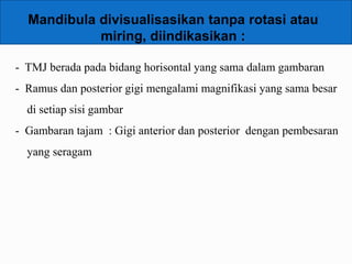 Teknik Radiografi 2 Panoramic | PPTX