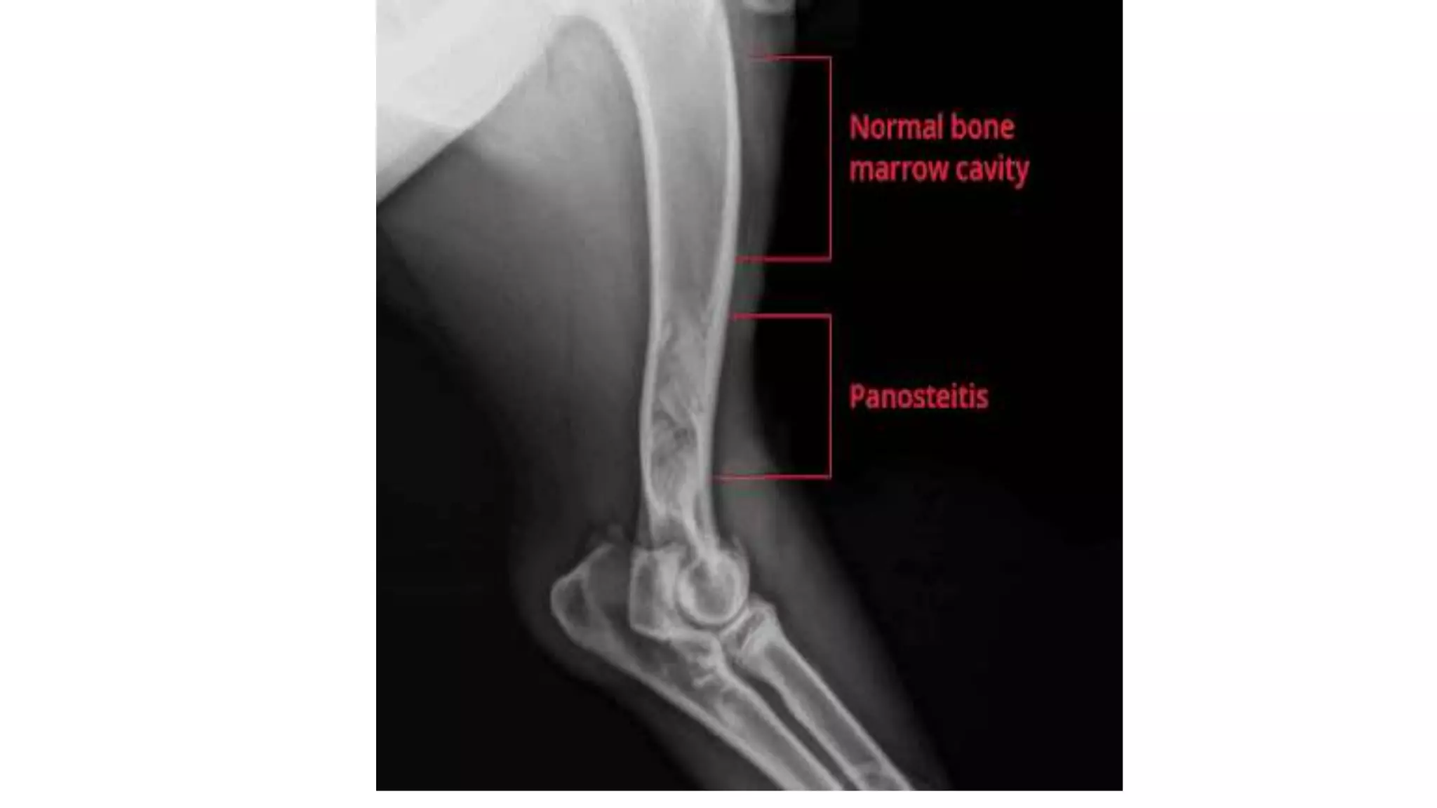 Panosteitis canina | PPT