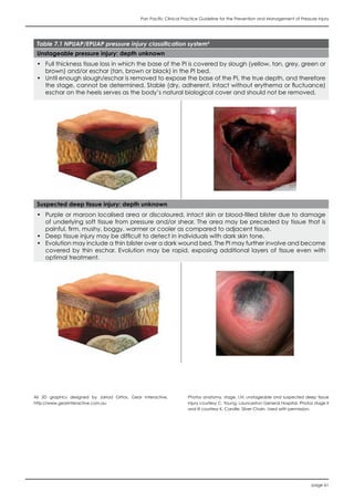 Pan pacific clinical practice guideline for the prevention and ...