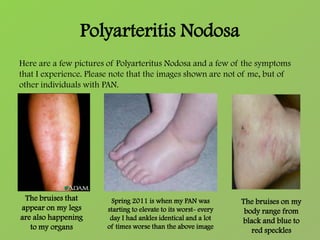 On the Way to Wellness | PPT