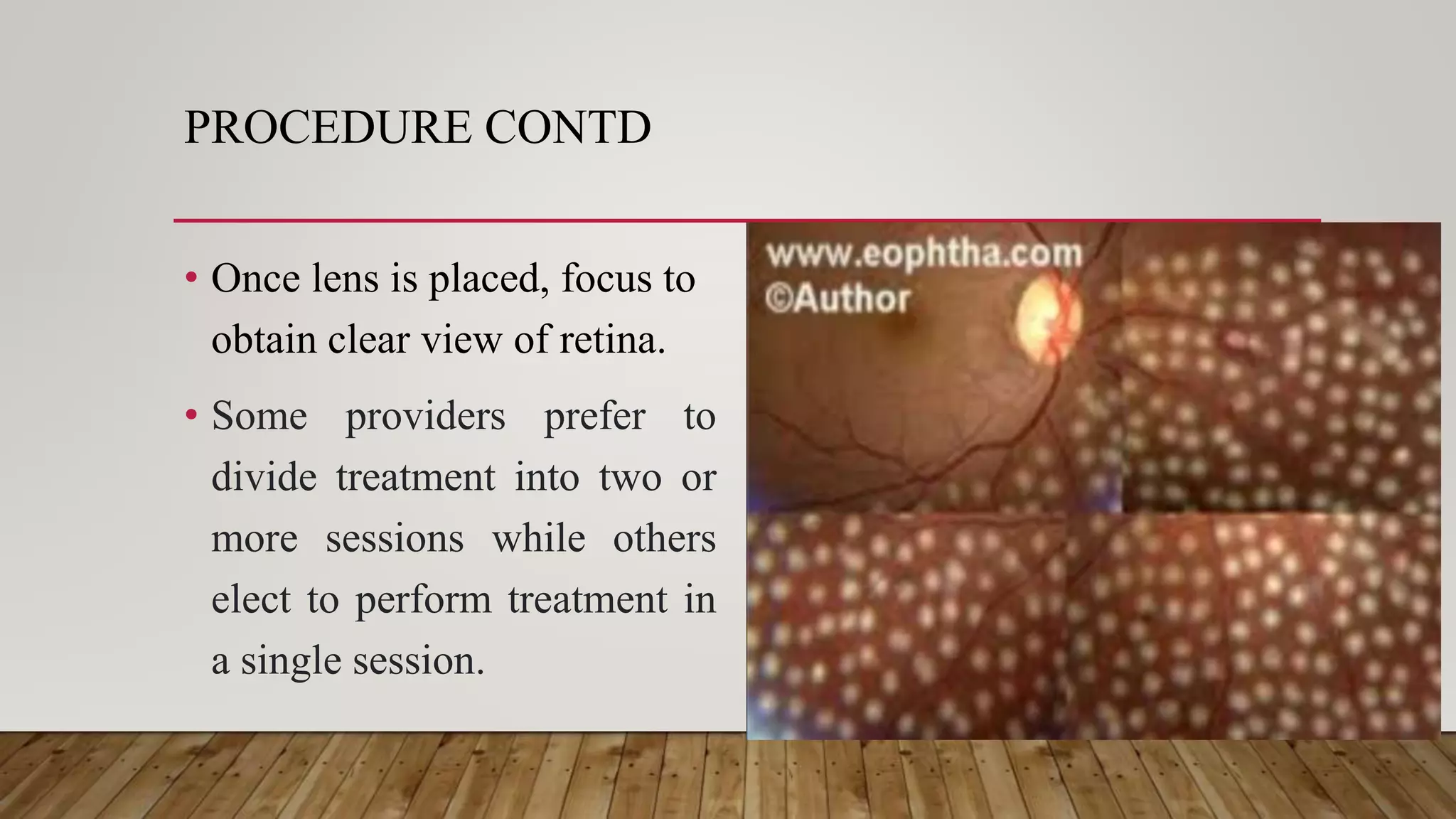 BASICS OF PAN RETINAL, SECTOR AND FOCAL RETINAL LASER PHOTOCOAGULATION.pptx