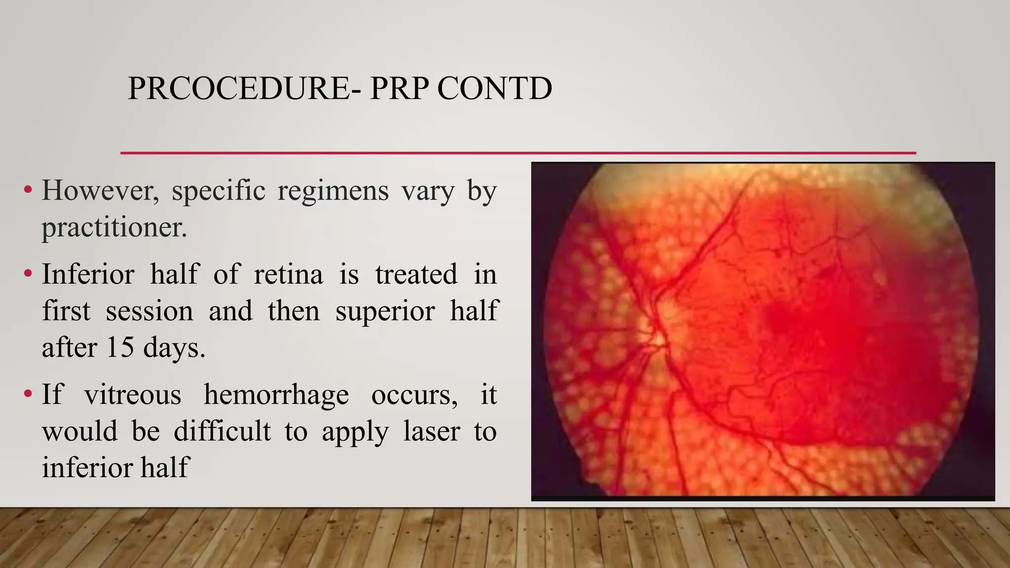 BASICS OF PAN RETINAL, SECTOR AND FOCAL RETINAL LASER PHOTOCOAGULATION.pptx