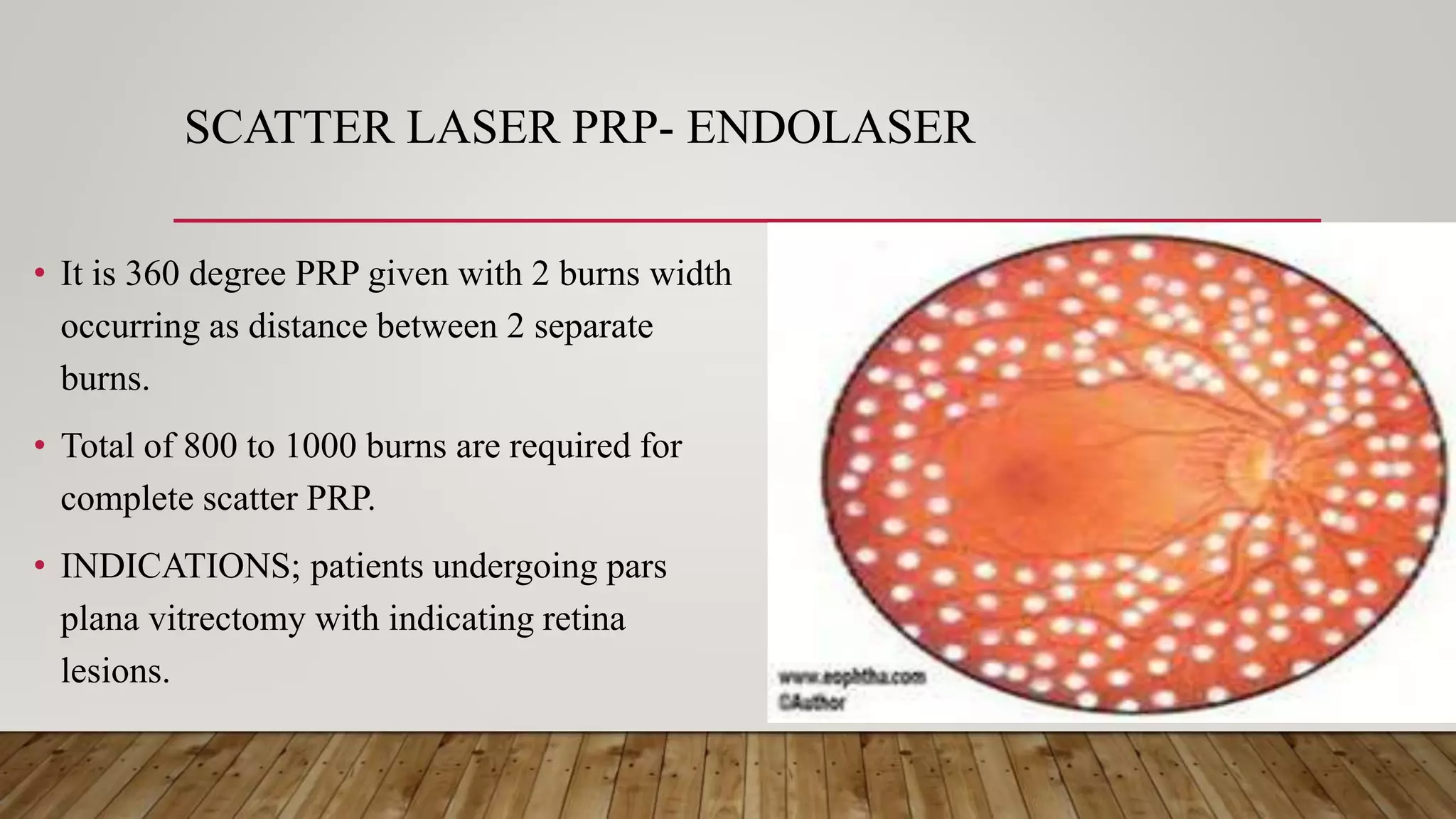 BASICS OF PAN RETINAL, SECTOR AND FOCAL RETINAL LASER PHOTOCOAGULATION.pptx