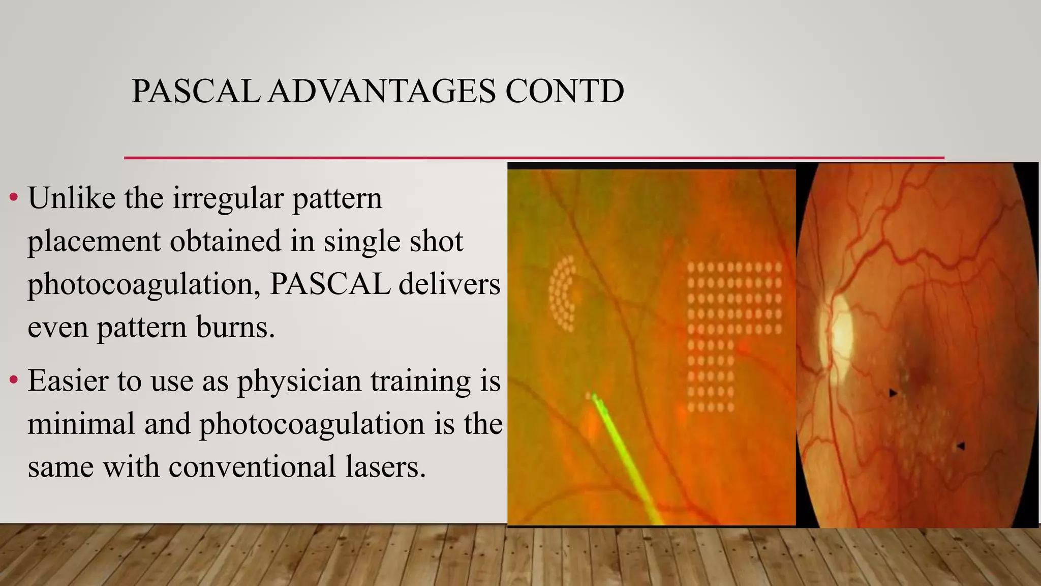 BASICS OF PAN RETINAL, SECTOR AND FOCAL RETINAL LASER PHOTOCOAGULATION.pptx