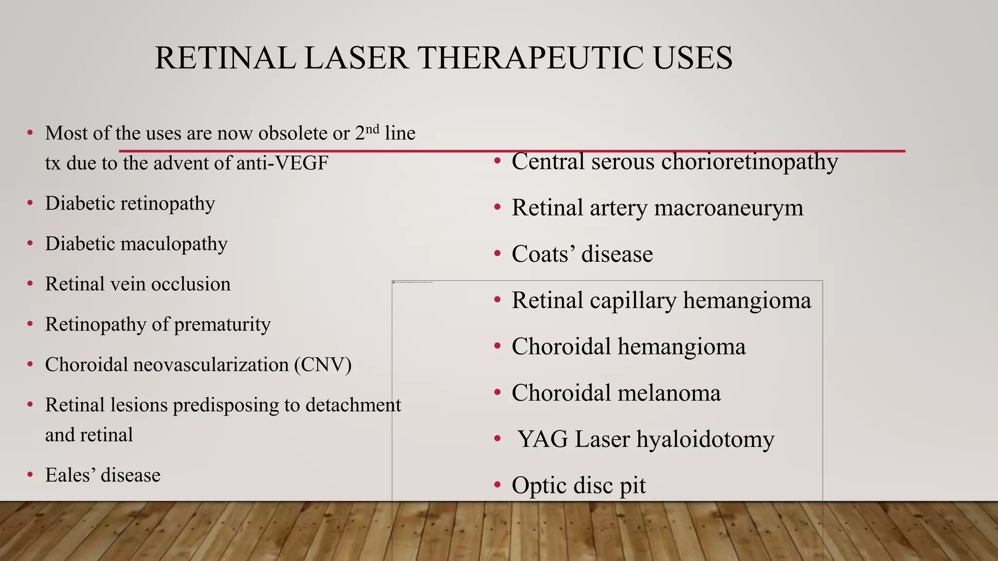 BASICS OF PAN RETINAL, SECTOR AND FOCAL RETINAL LASER PHOTOCOAGULATION.pptx
