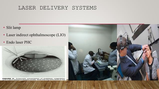 BASICS OF PAN RETINAL, SECTOR AND FOCAL RETINAL LASER PHOTOCOAGULATION ...
