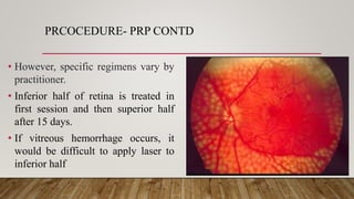 BASICS OF PAN RETINAL, SECTOR AND FOCAL RETINAL LASER PHOTOCOAGULATION.pptx