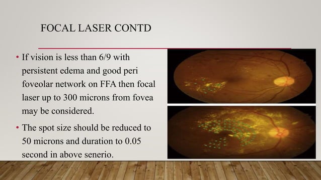 BASICS OF PAN RETINAL, SECTOR AND FOCAL RETINAL LASER PHOTOCOAGULATION ...