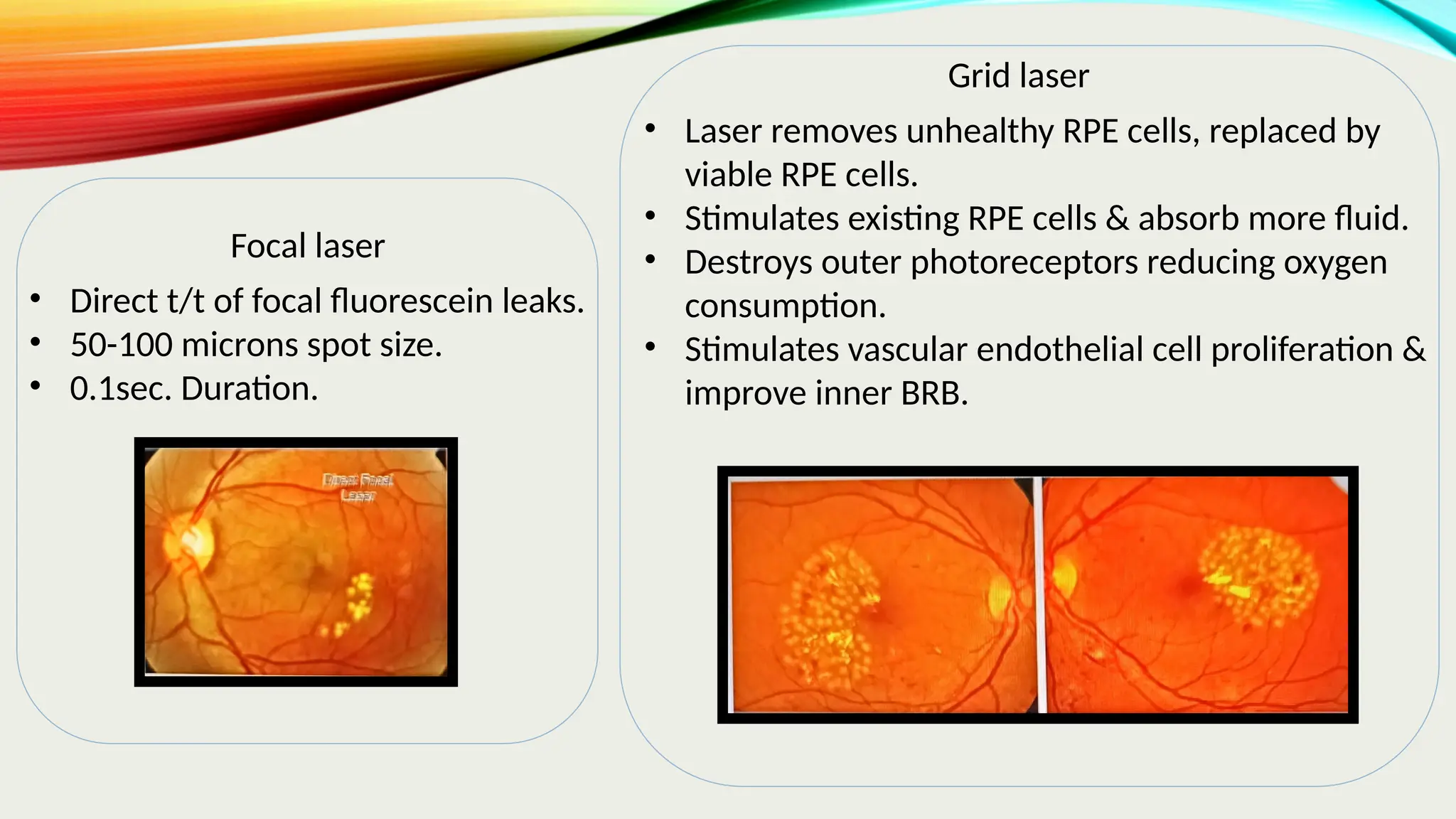 All about Pan Retinal Photocoagulation.pptx