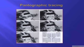 pantograph .pptx