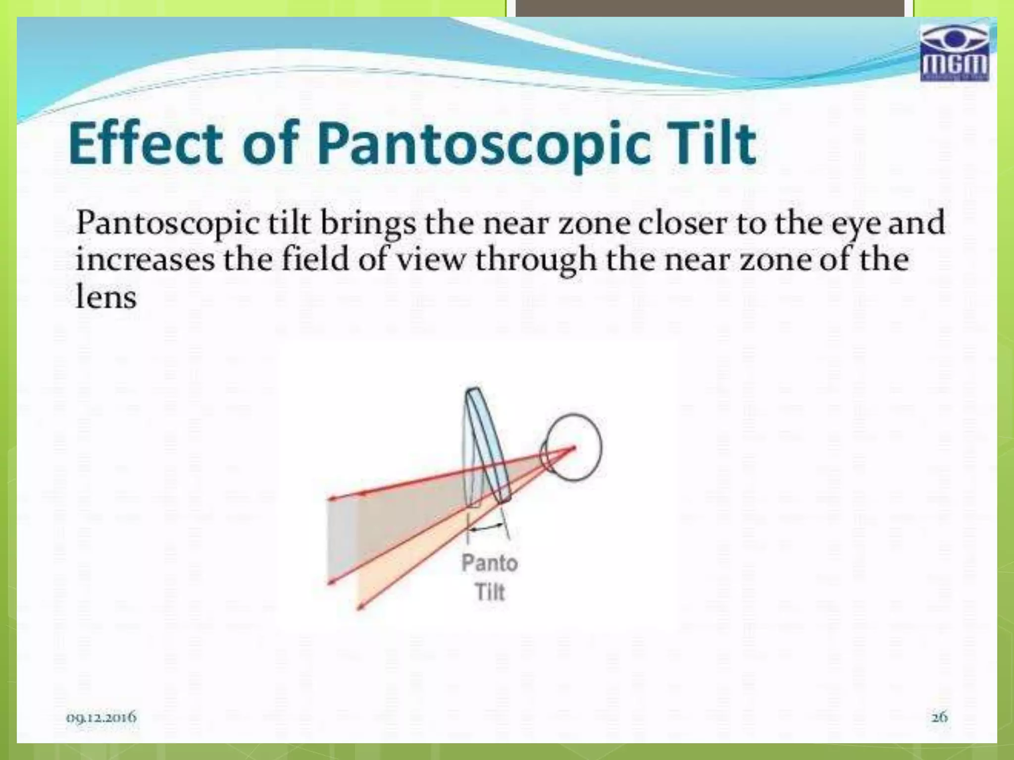 Pantoscopic tilt | PPTX