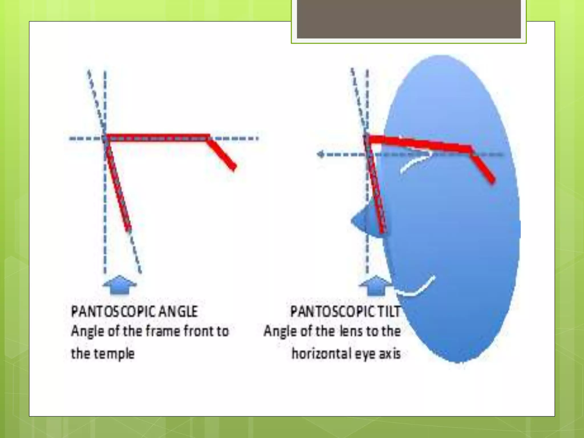 Pantoscopic tilt | PPTX