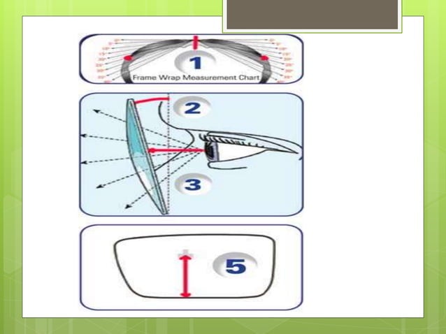 Pantoscopic tilt | PPTX | Eye and Vision Conditions | Diseases and ...