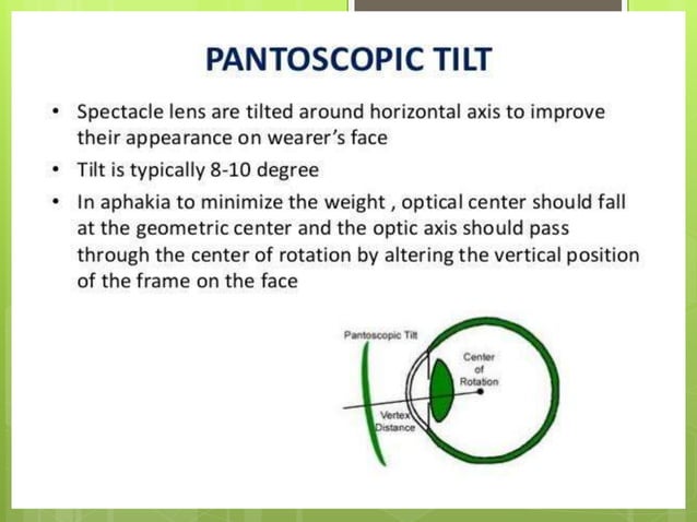 Pantoscopic tilt | PPTX | Eye and Vision Conditions | Diseases and ...