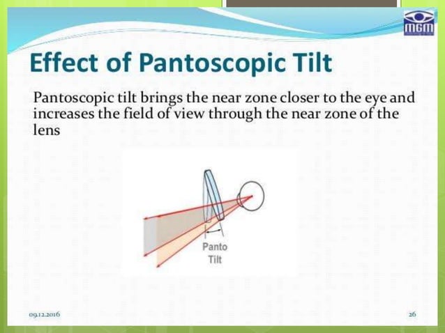 Pantoscopic tilt | PPTX | Eye and Vision Conditions | Diseases and ...