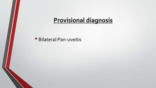 Pan-uveitis both eye (case presentation) | PPTX