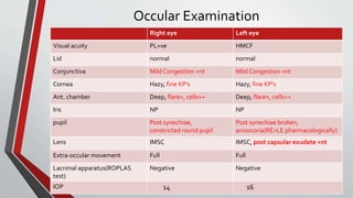 Pan-uveitis both eye (case presentation) | PPTX