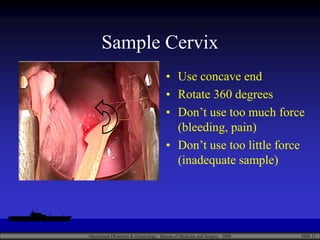 COLLECTION AND SMEARING TECHNIQUES FOR PAP SMEARS | PPT