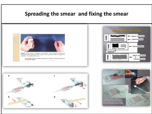 pap-smear-interpretation.pptx | Cancer | Diseases and Conditions