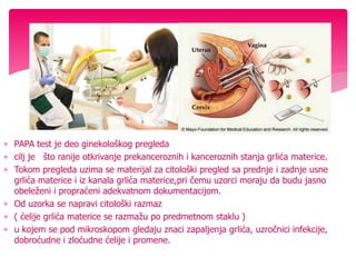 Papa test | PPTX