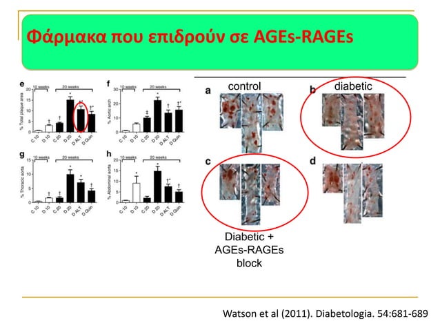 Papatheodorou K 10o atherosclerosis.ppt