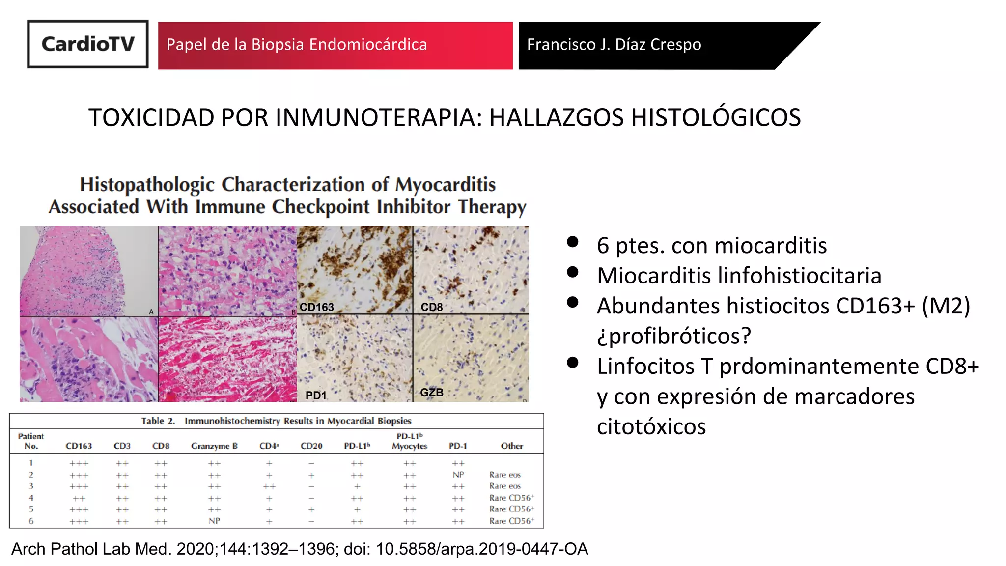 Papel de la biopsia endomiocárdica | PPT