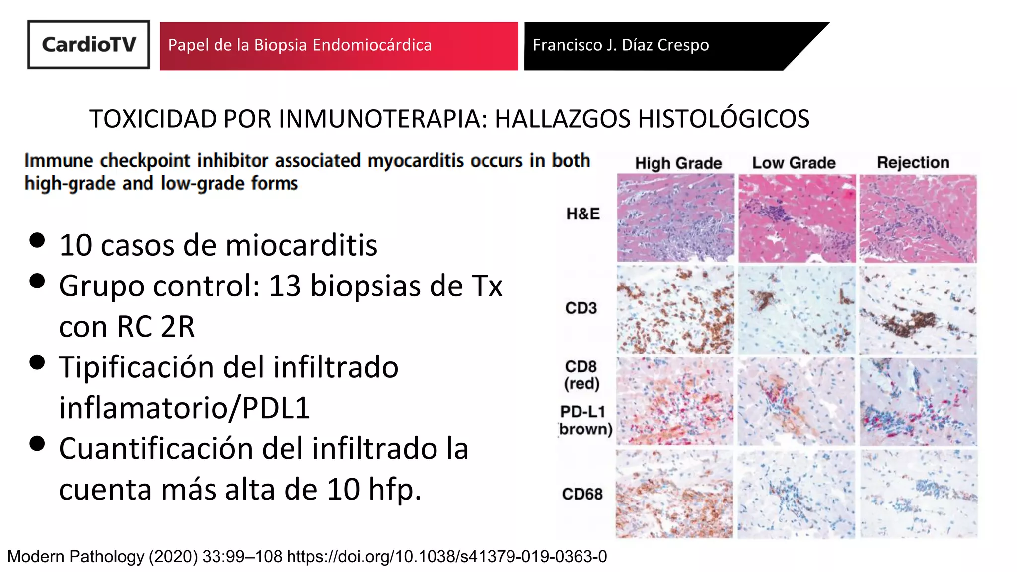 Papel de la biopsia endomiocárdica | PPT