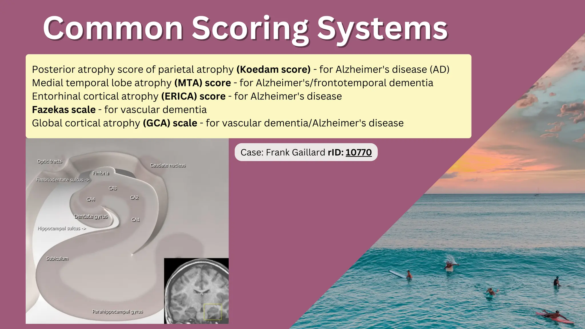 Papel de la resonancia magnética en las enfermedades neurodegenerativas.pdf