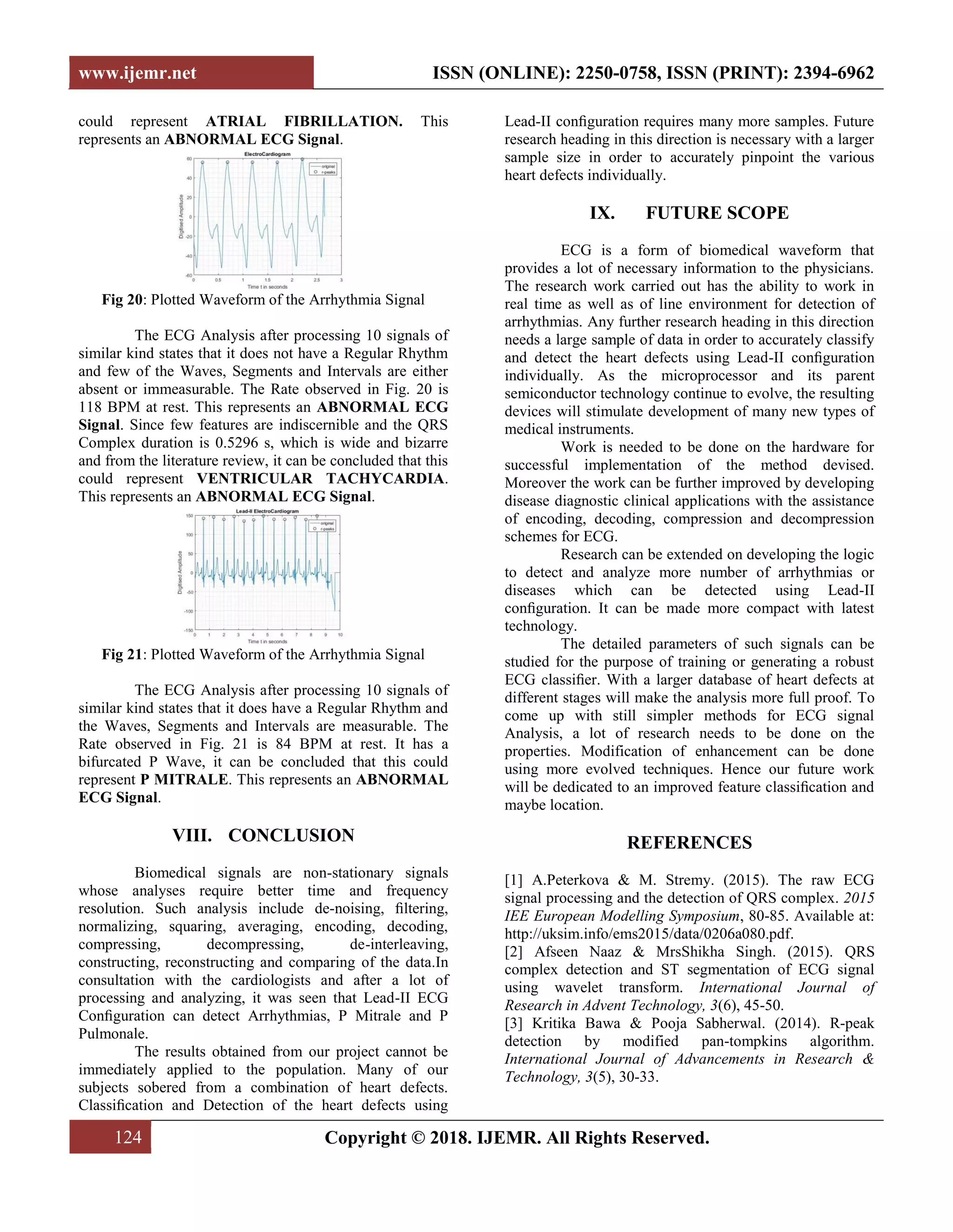Classification Of Arrhythmia From Ecg Signals Using Matlab Pdf
