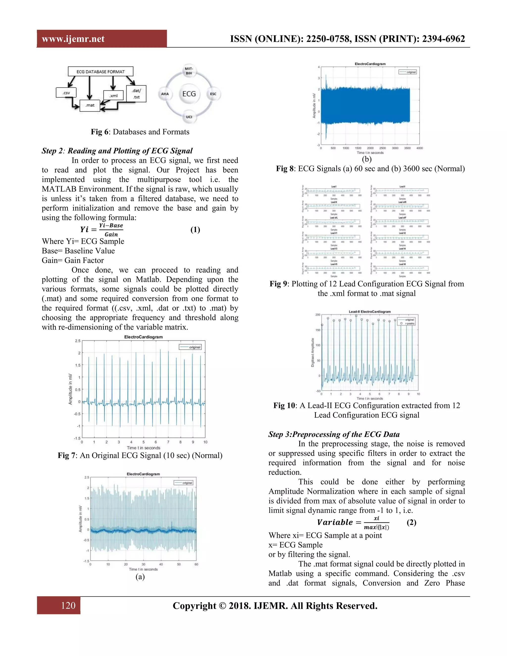 Classification Of Arrhythmia From Ecg Signals Using Matlab Pdf Heart And Cardiovascular
