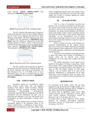 Classification of Arrhythmia from ECG Signals using MATLAB | PDF | Heart and Cardiovascular ...
