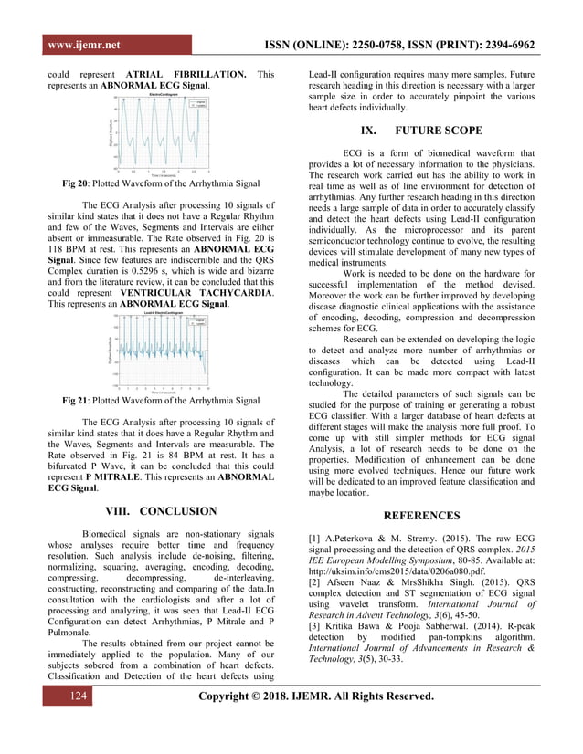 Classification of Arrhythmia from ECG Signals using MATLAB | PDF | Heart and Cardiovascular ...