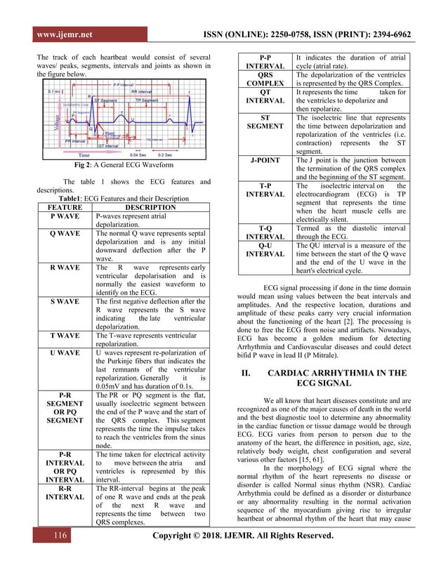 Classification of Arrhythmia from ECG Signals using MATLAB | PDF | Heart and Cardiovascular ...