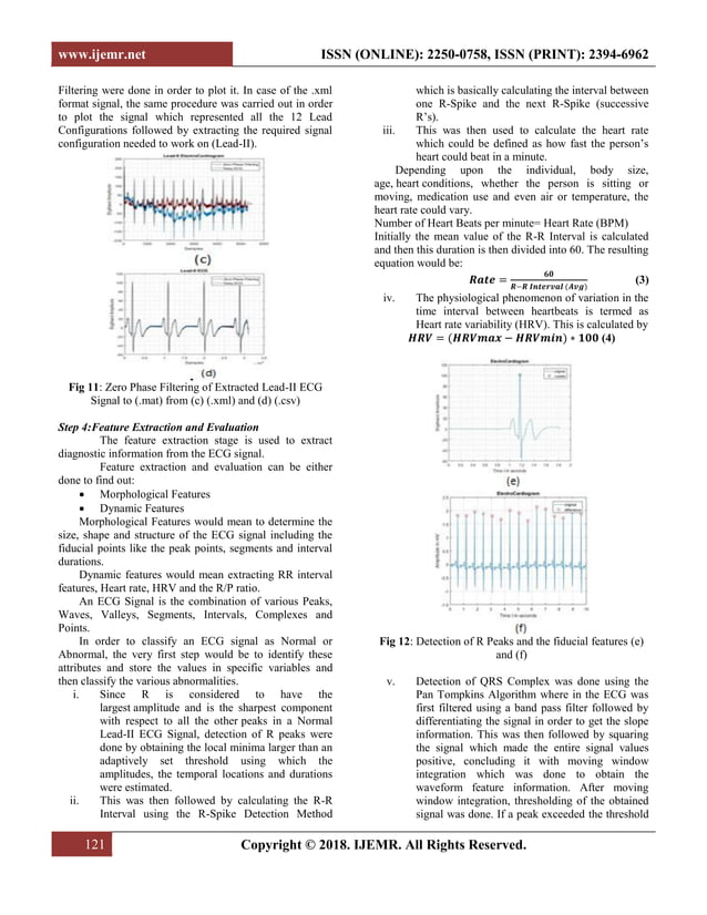 Classification Of Arrhythmia From Ecg Signals Using Matlab Pdf