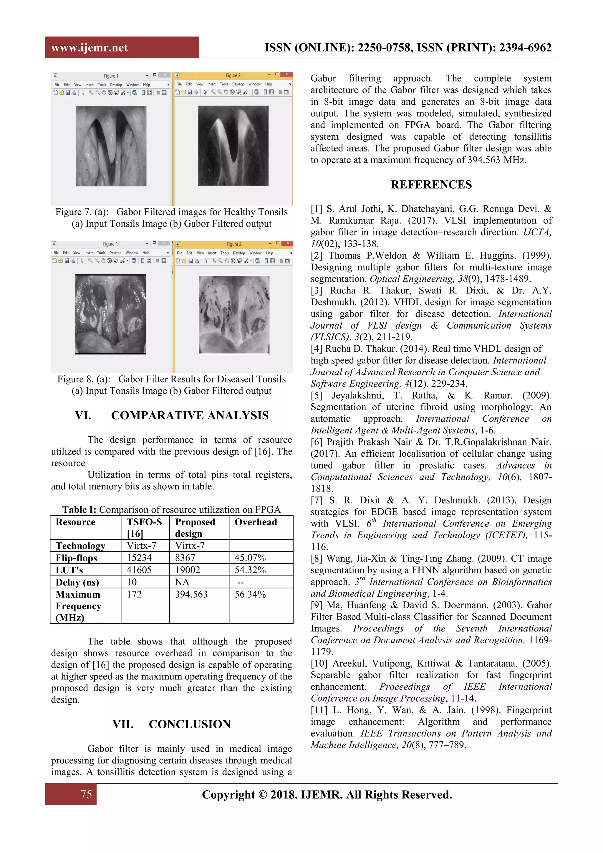 Development and Implementation of VLSI Reconfigurable Architecture for Gabor Filter in Medical ...