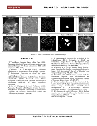 Follicle Detection in Digital Ultrasound Images using Bi-Dimensional Empirical Mode ...