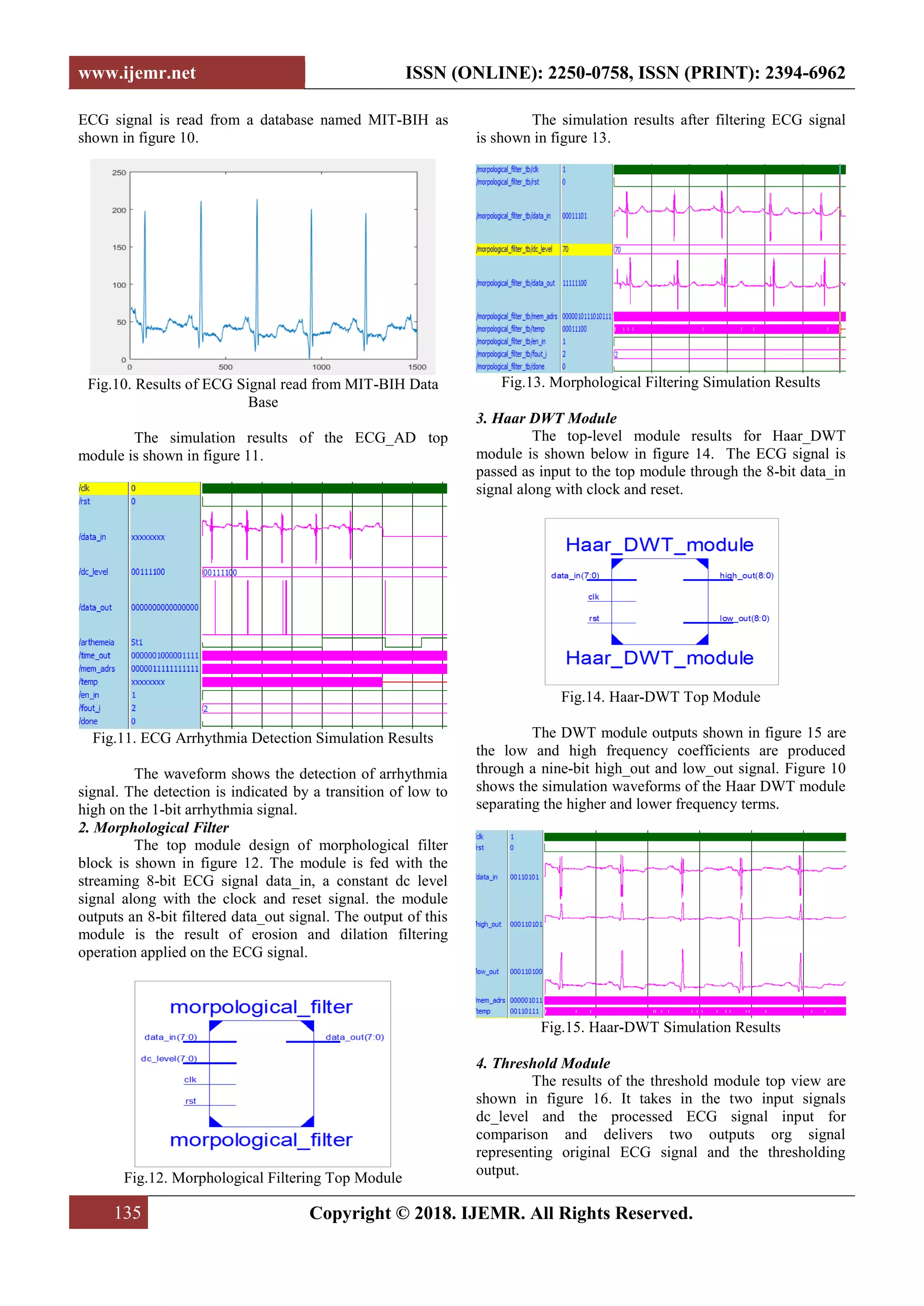 An Electrocardiograph based Arrythmia Detection System | PDF