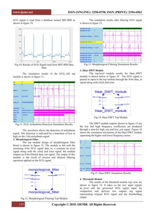 An Electrocardiograph based Arrythmia Detection System | PDF