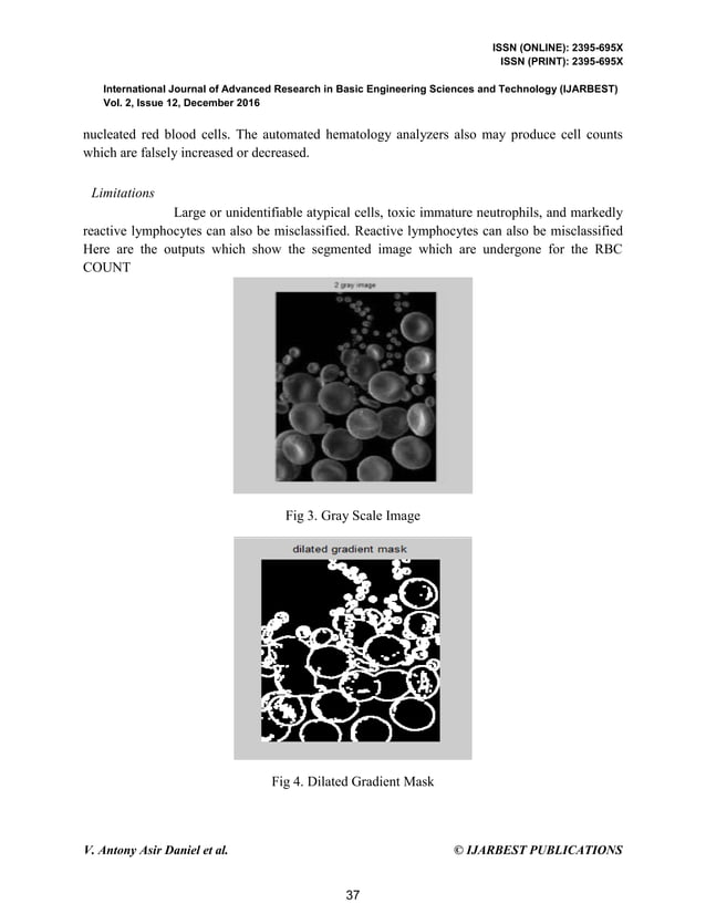 Segmentation and Automatic Counting of Red Blood Cells Using Hough Transform | PDF