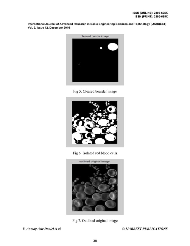 Segmentation and Automatic Counting of Red Blood Cells Using Hough Transform | PDF