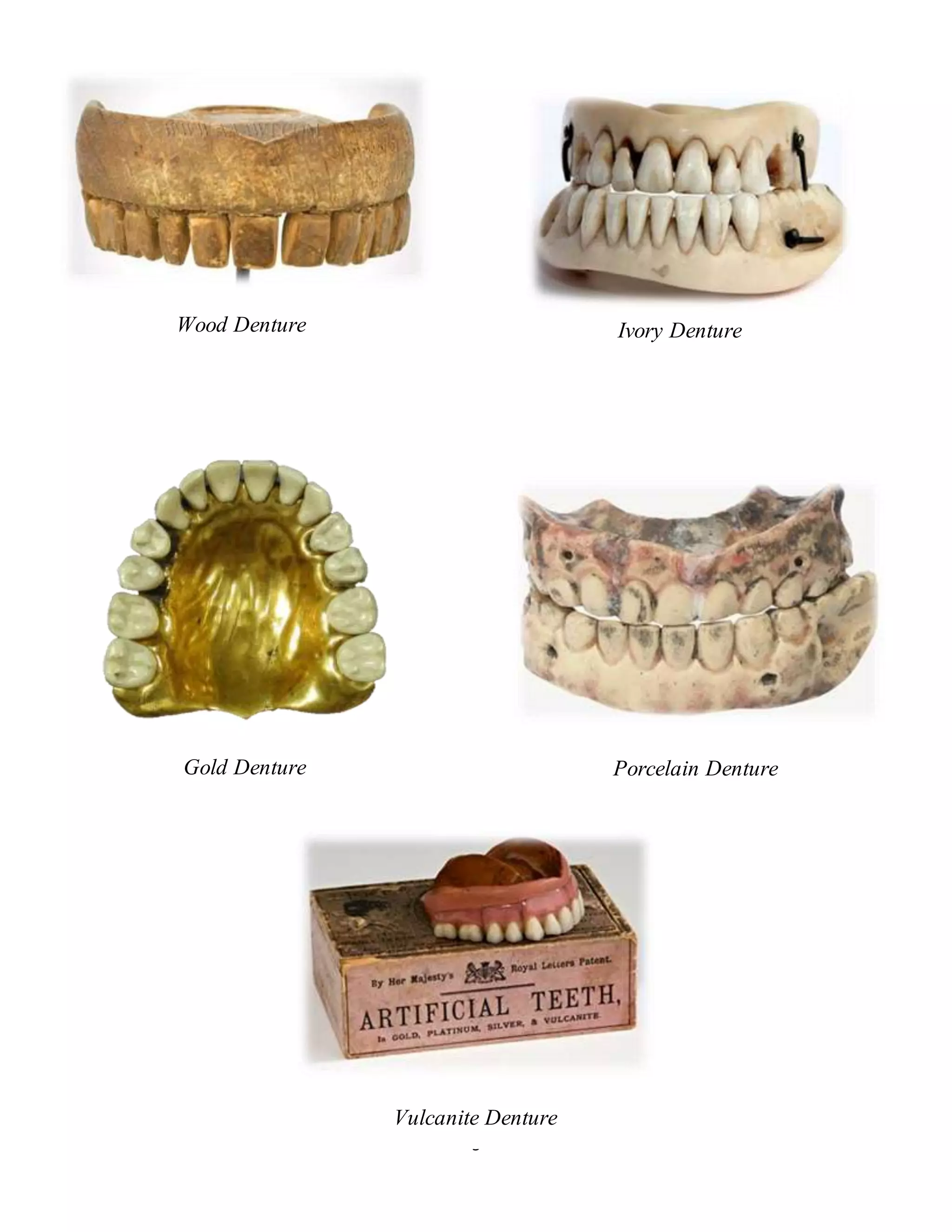 Recent trends of denture base materials | DOCX