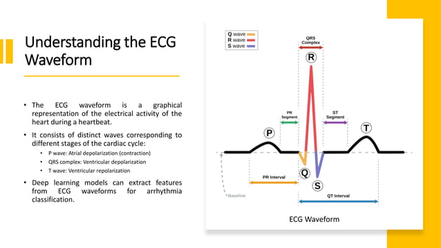 Cardiac Arrhythmia Detection Using Artificial Intelligence Pptx