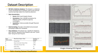 Cardiac arrhythmia detection using artificial intelligence | PPTX