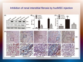 human umbilical cord mesenchymal based renal therapy | PPT