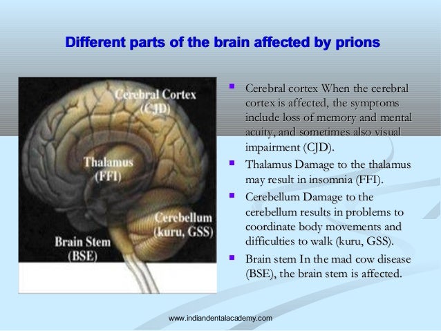 Prions disease / dental implant courses