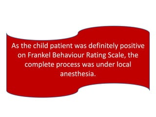 Dr Rahul Katyayan. Odontogenic Keratocyst in Child Head &Neck Region | PPTX
