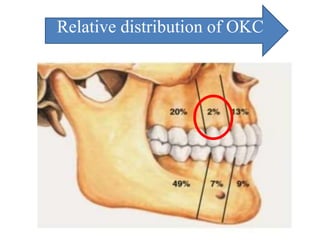 Dr Rahul Katyayan. Odontogenic Keratocyst in Child Head &Neck Region | PPTX