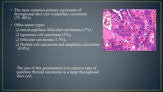 A CASE REPORT ONPAPILLARY THYROID CARCINOMA OF LARGE THYROGLOSSAL CYST.pptx