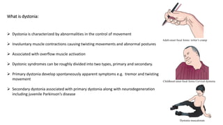 Paper presentation dystonia 031220 | PPT